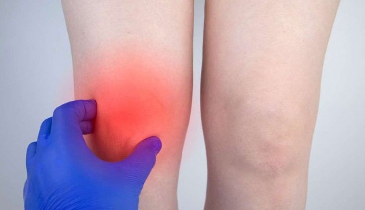 Edema Óseo, qué es y cómo tratarlo - Viten