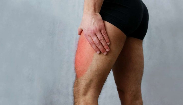 Meralgia Parestésica qué es y como se trata - Viten